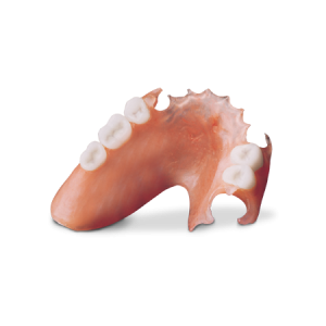 Valplast Partial – All American Dental Lab